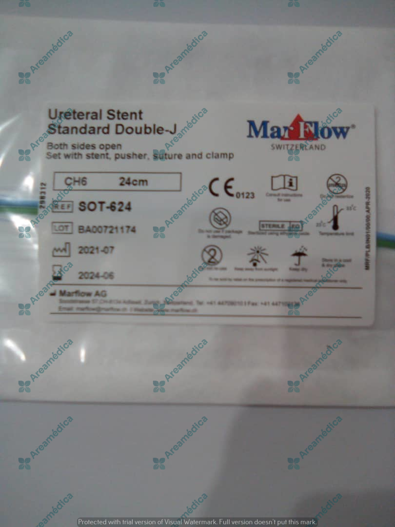 Cateter Ureteral Estandar Doble J 6FR x 24cm Corta Duracion